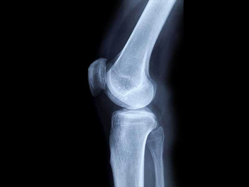 Czym jest osteogeneza? - EdukacjaMedyczna.pl