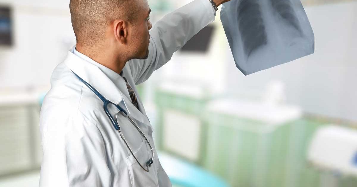 Pneumonektomia: kiedy jest wykonywana i jak resekcja płuca wpływa na ...